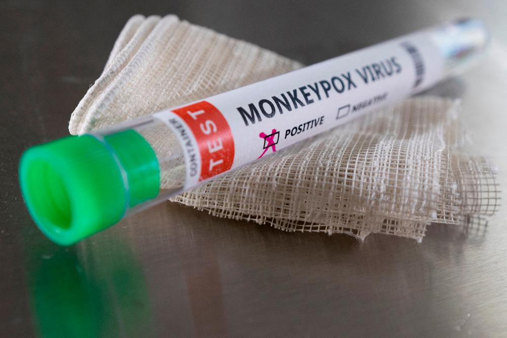 Russia confirms first monkeypox case: Consumer rights watchdog
